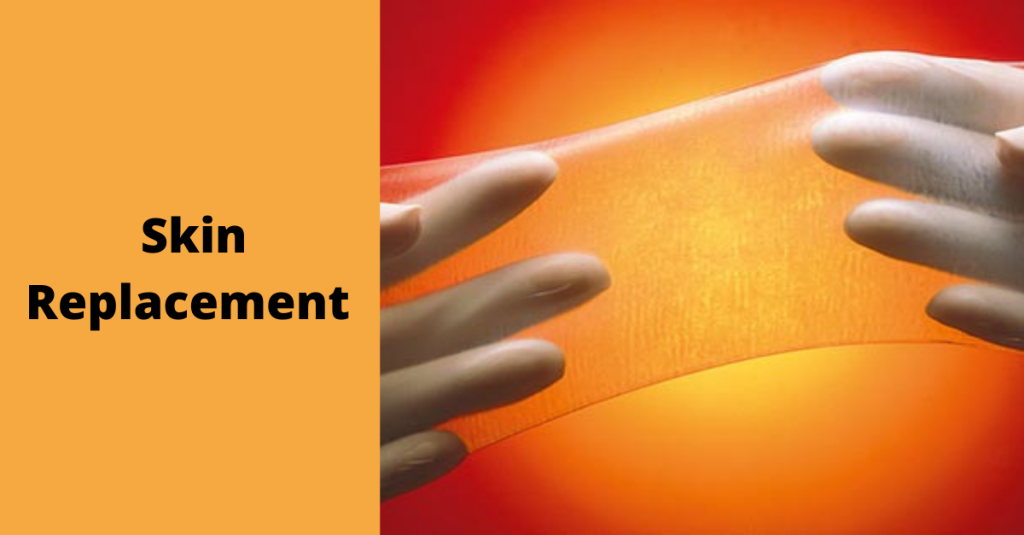 Skin Replacement Market – Know-How Industry to Experience Positive ...